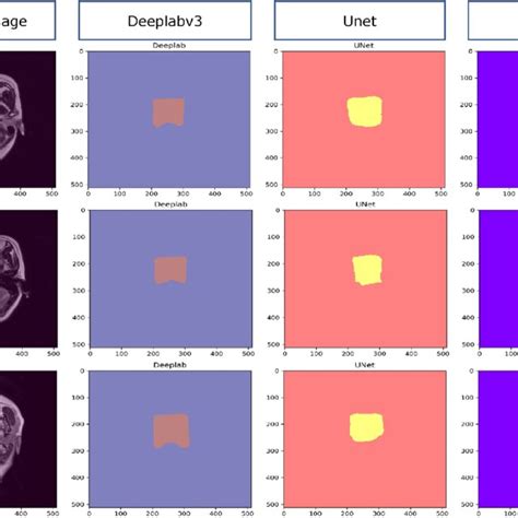 Segmentation Examples Of U Net And Deeplabv3 Download Scientific Diagram
