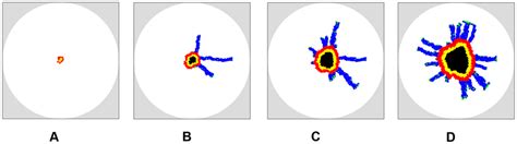Evolution Of Simulated Tumor In Homogeneous Ecm With The Mutation