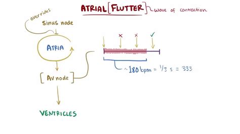Atrial Flutter Atrial Flutter Msd Manual Professional Edition