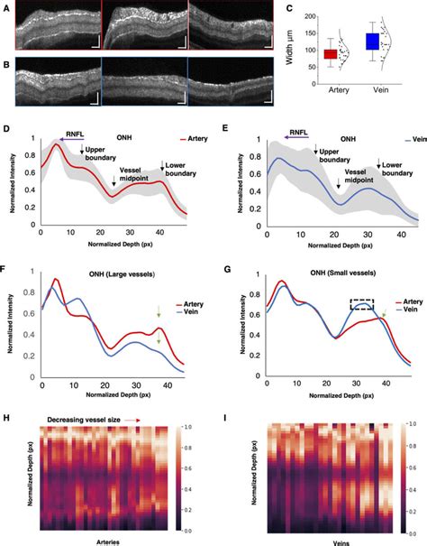 Quantitative Cross Sectional Profile Analysis For Av Classification Download Scientific