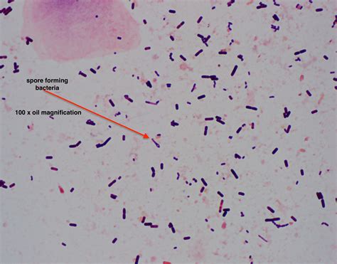 Clostridium Spore Clinical Avian Pathology Services