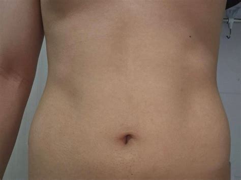 20살남자인데 골반이 넓은건가요 지식in