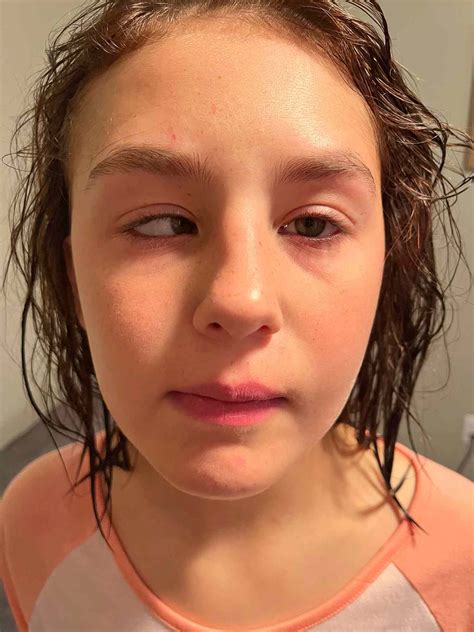 Meet The Teen Living With Céline Dions Stiff Person Syndrome