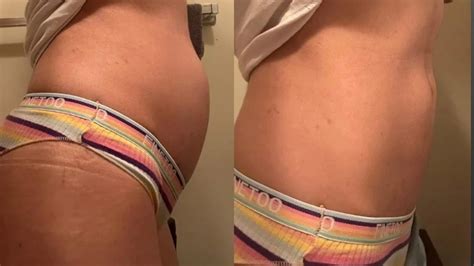 Bladder Bulge Extreme Bladder Bulge Pee