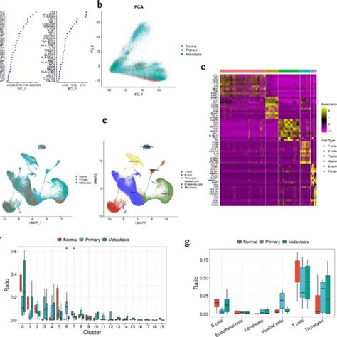 heterogeneity of ptc lnm in malignant cells a volcano map of degs in