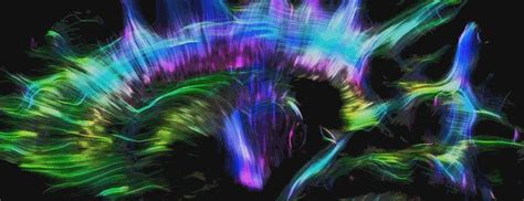 Diffusion Tensor Imaging For Multiple Sclerosis Diagnosis Inside Ucr
