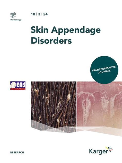 A Case Of Dissecting Cellulitis Of The Scalp Hidradenitis Suppurativa And Conglobate Acne