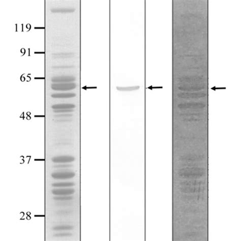 Dna Affinity Chromatography Of H Obtusa Ifs P Caudatum Dna Was Used