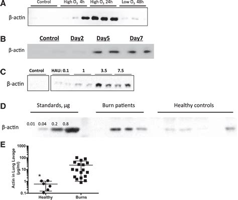 Figure 1 From Free Actin Impairs Macrophage Bacterial Defenses Via