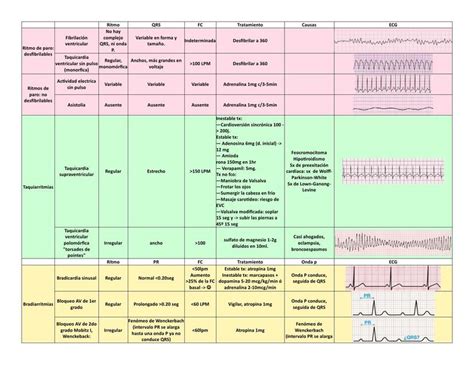 Tabla Ritmos De Paro Medika Notes Udocz