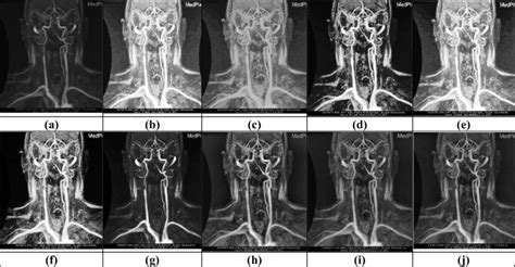 Input Image And Related Enhancement Performance Using Various