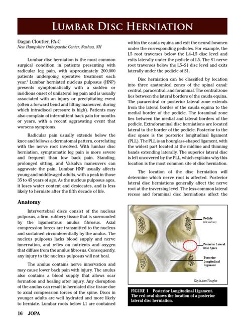 Lumbar Disc Herniation Pdf Back Pain Surgery