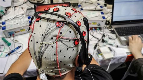 Als Patients Control Home Devices With Their Minds Using Bci