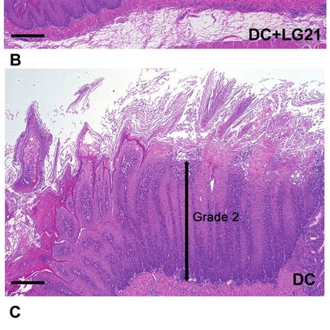 Probiotic Yogurt Containing Lactobacillus Gasseri Oll2716 Suppressed