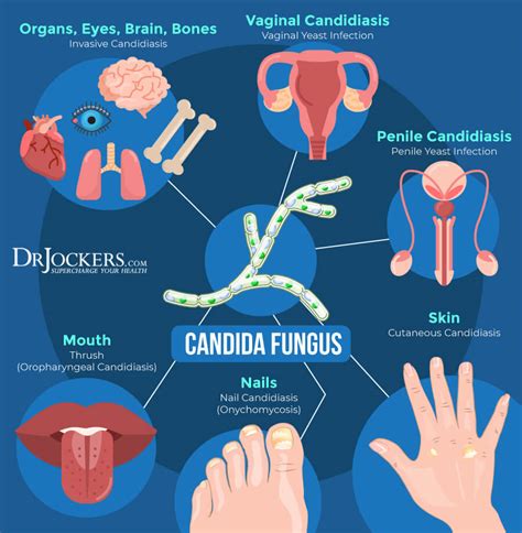 Toenail Fungus Symptoms Causes And Support Strategies