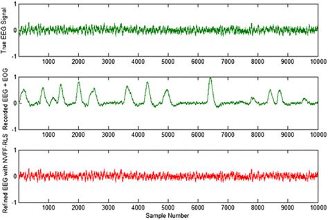 Refined Eeg Signal Red Colored At The Output Of Nvff Rls Based Download Scientific Diagram