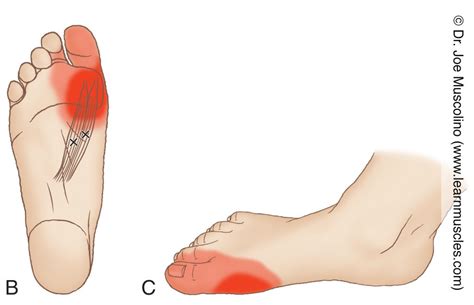 Flexor Hallucis Brevis Trigger Points Learn Muscles
