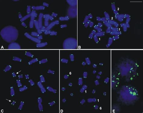 Fish Using A Telomeric Probe In Leptodactylus A Mitotic Metaphase Of