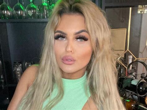 Love Island Jagoda Na Starym Zdjęciu Jeszcze Przed Operacjami