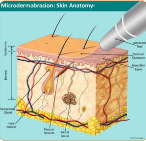 Microdermabrasion And Skin Anatomy Picture