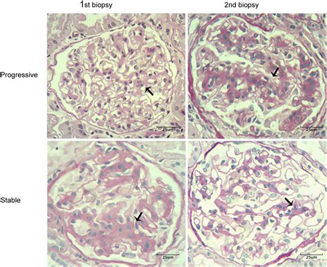 Mesangial Cell Histology