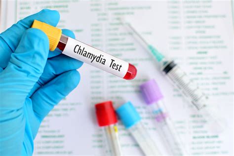 Chlamydia Trachomatis Igg