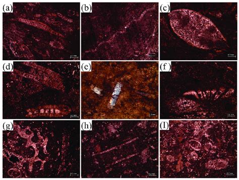 Photomicrographs Showing A Coralline Algae And Idalina Grelaudae