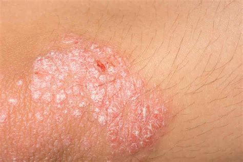 10 Sinais Podem Indicar A Presença De Um Câncer De Mama