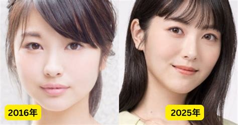【画像比較】浜辺美波は整形で顔変わった？デビューから時系列で徹底検証！