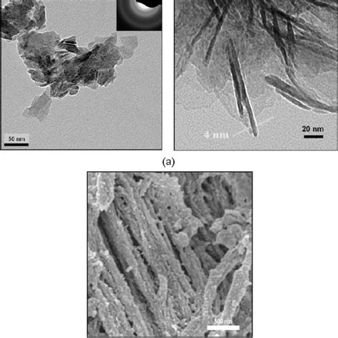 2 Elastic Modulus Of Trabecular Femoral Bone Download Table