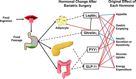 Frontiers Bariatric Surgery Targeting Pancreatic β Cells To Treat