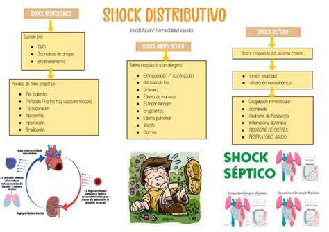 Mapa Shock Distributivo Pdf
