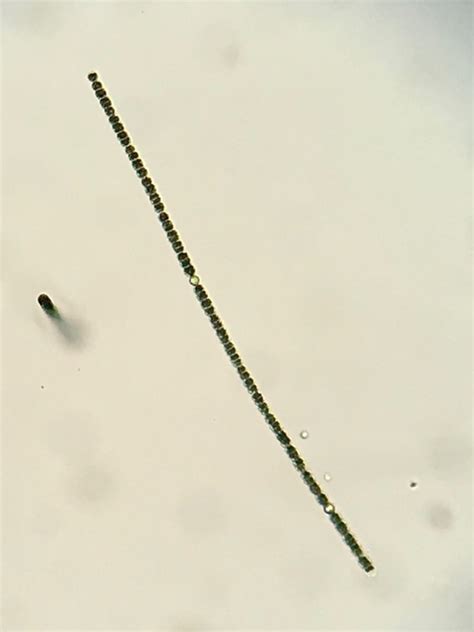 Dolichospermum From 日本、宮城県仙台市泉区 On August 30 2020 By Amayakan Cell Size Trichome 7 8 µm In