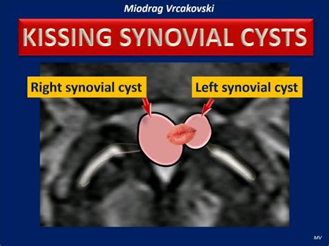 Miodrag Vrcakovski On Linkedin Neuroradiology Radiology Neurosurgery