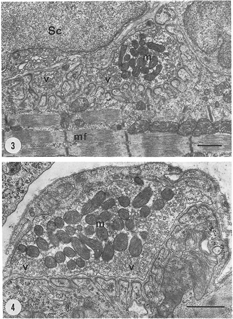 Figur~ 4 Electron Micrograph Of A Portion Of A Neuromuscular Junction