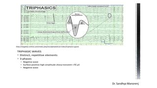Triphasic Waves In Eeg Pptx