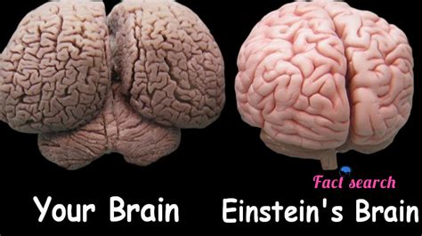 Albert Einsteins Brains Wtf Fun Facts Facts
