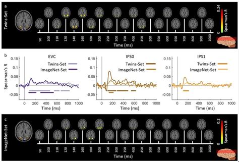 Spatiotemporal Neural Dynamics Of Vision In Dorsal Stream A An Axial Download Scientific
