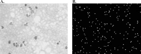 Image Comparison Of The Direct Microscopic Somatic Cell Counts Dmscc