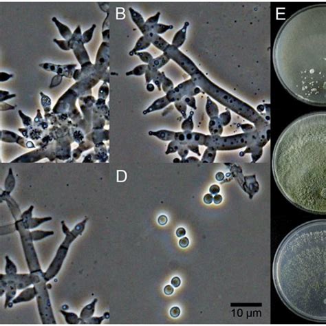 Trichoderma Harzianum Kuc21203 A C Conidiophore D Conidia Scale