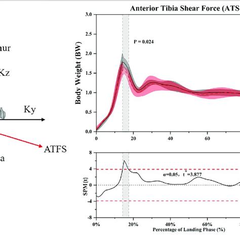 The Statistical Parametric Mapping Spm Results Between Ns And Bs