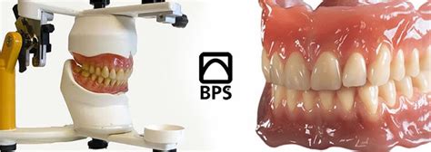 Suction Lower Denture Abacus Dental Studio