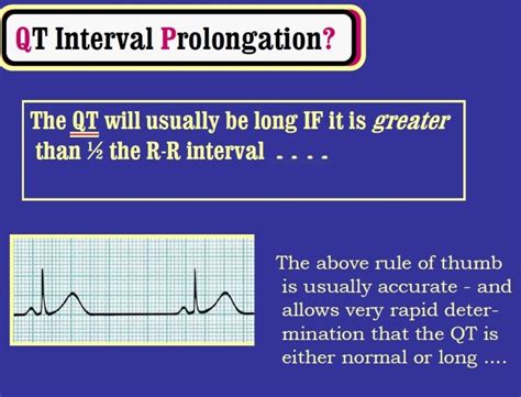 Qt Prolongation Qt Prolongation Syndromeqt연장증후군 네이버 블로그