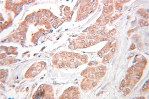 Keap1 Antibody 10503 2 Ap Proteintech