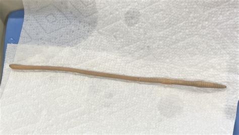 External Earthworm Identification Diagram Quizlet