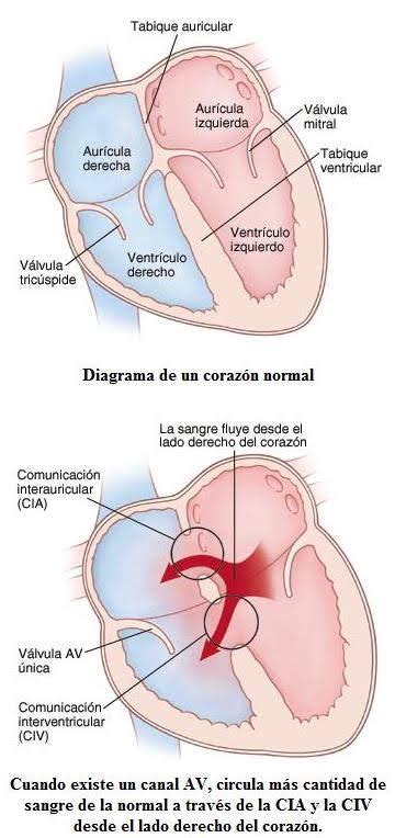 Cardiología Pediátrica Pediatría