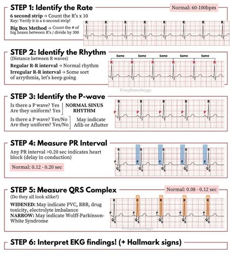 Ecg Review I Medizzy Ecg Review I Medizzy