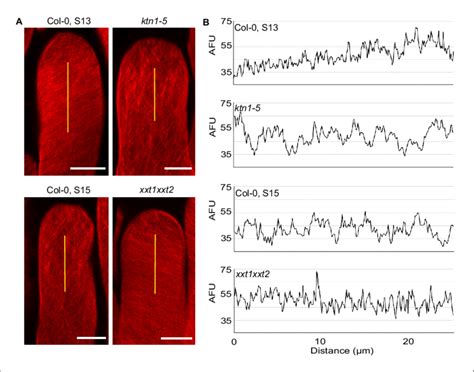 Cellulose Microfibril Organisation In Col 0 Stage 13 Ktn1 5 Col 0