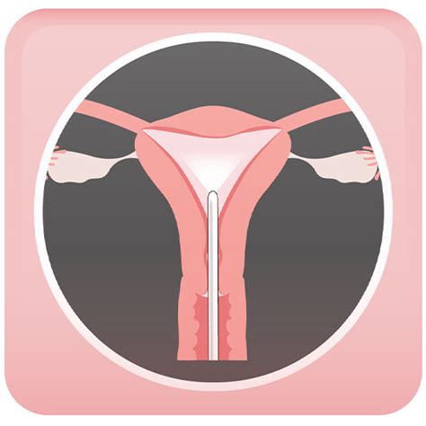 Patient Handout Project Gynaecology Collaboration