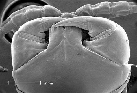 Centipede Under A Microscope